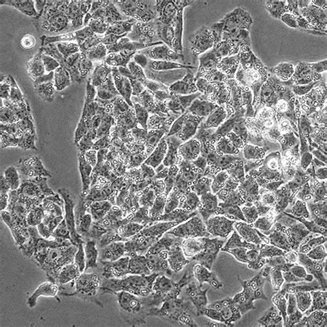 Hepg2 Cell Line History Hep G2 Odvwg