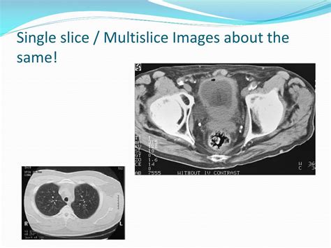 Ppt Multi Slice Ct Powerpoint Presentation Free Download Id5573730
