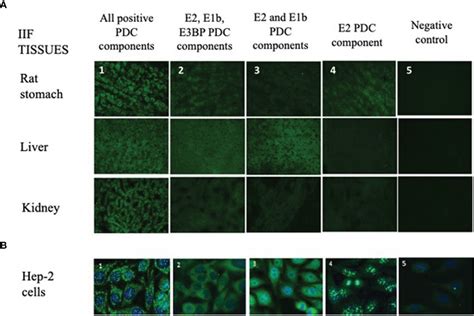 Different Iif Patterns Of Ama Positive Patients On Tissue Sections And Download Scientific