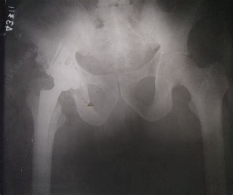 Intraoperative Fluoroscopy Download Scientific Diagram