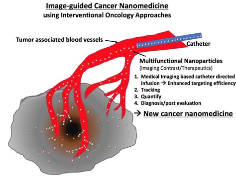 Image Guided Cancer Nanomedicine Image Guided Infusion Of Nanomedicine