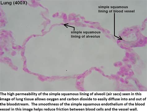 Simple Squamous Epithelium Labeled