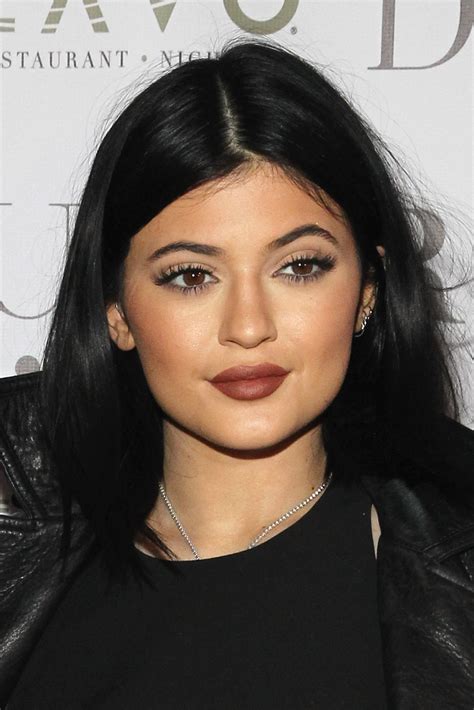 Kylie Jenner Prima E Dopo La Chirurgia Comè Cambiata La Giovane