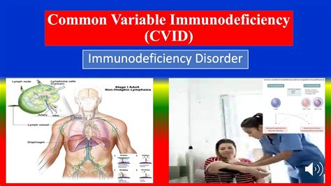 Common Variable Immunodeficiency Cvid Definition Types Pathophysiology Symptom Medicine