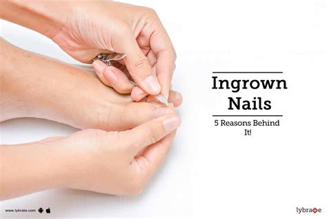 Ingrown Nails 5 Reasons Behind It By Dr Priyali Shah Lybrate