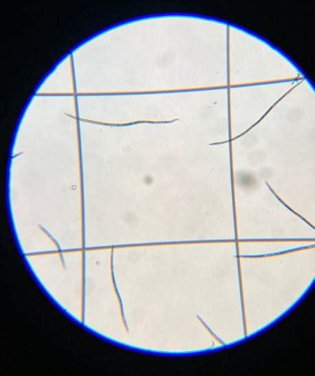 Researchers Develop New Detection Tool For Beech Leaf Diseases Nematode Pest Other Hfandg