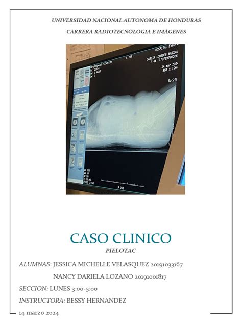 Caso Clinico Pielotac Pdf Sistema Urinario Medicina