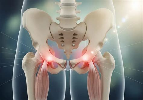 Pubalgia E Tratamento Descubra Causas E Soluções Para Aliviar A Dor
