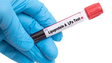 Lipoprotein A Levels Testing And Treatment For Heart Disease