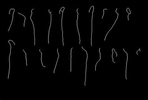 How To Perform An Automated Image Analysis Of Skeleton Length In Imagej
