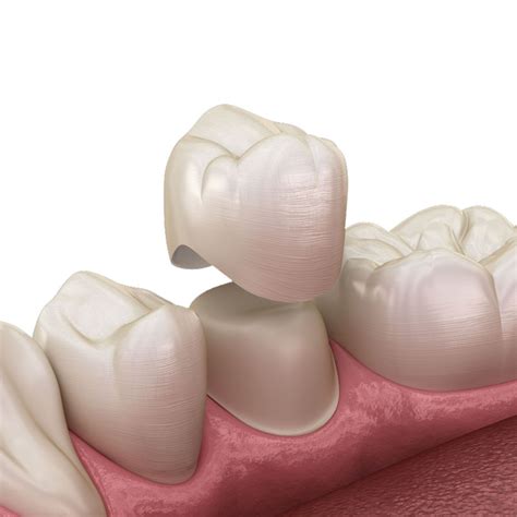 Krunice Dental Clinic Pelivan