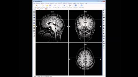 Brainvoyager Tutorial Analysis In Standard 3d Space Part 1 Youtube