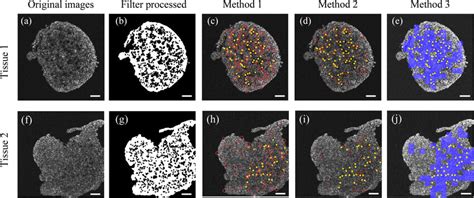 Oct Images And The Detection Results A And F Show Original Images Download Scientific