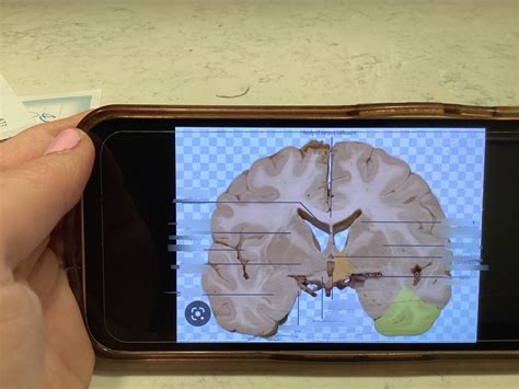 Neuro Lab Diagram Quizlet