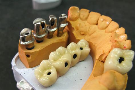 Лаборатория Prodeo Dental Technology