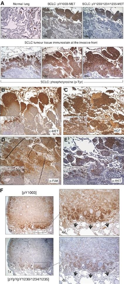 Downstream Signalling And Specific Inhibition Of C Met Hgf Pathway In