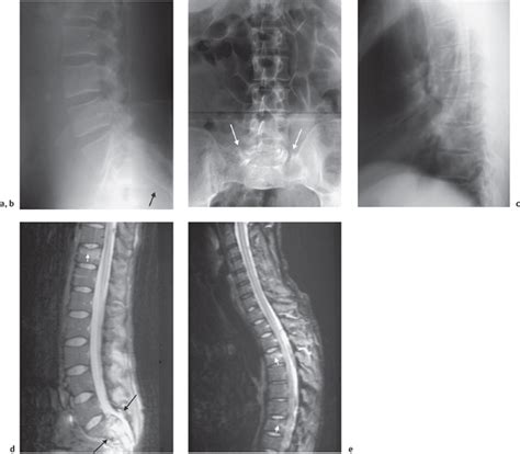 Optimizing The Imaging Options Radiology Key