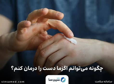 هر آنچه باید درباره اگزما دست بدانید علل بروز، تشخیص، درمان