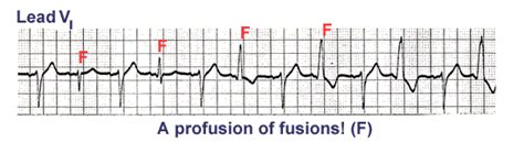 ECG Learning Center An Introduction To Clinical Electrocardiography