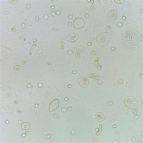 Transitional Epithelial Cells Medlabbuddy