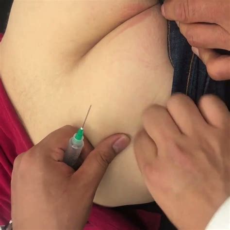 Butt Injection Video 330