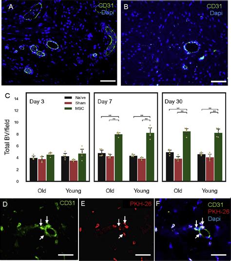 Mesenchymal Stem Cell Transplantation Improves Biomechanical Properties Of Vaginal Tissue