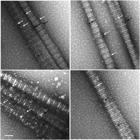 A Image Of A Network Of Collagen Type I Fibrils Obtained With Afm
