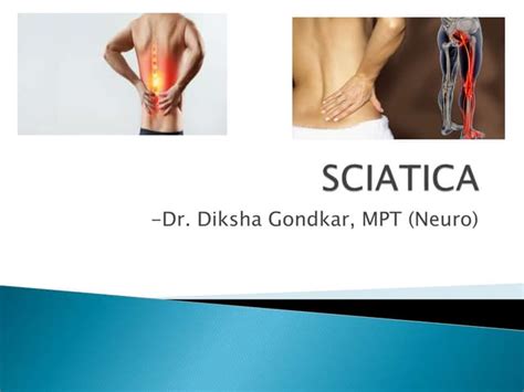 Rehabilitation Of Sciatica Pdf