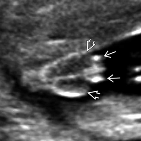 Abnormal Genitalia Radiology Key