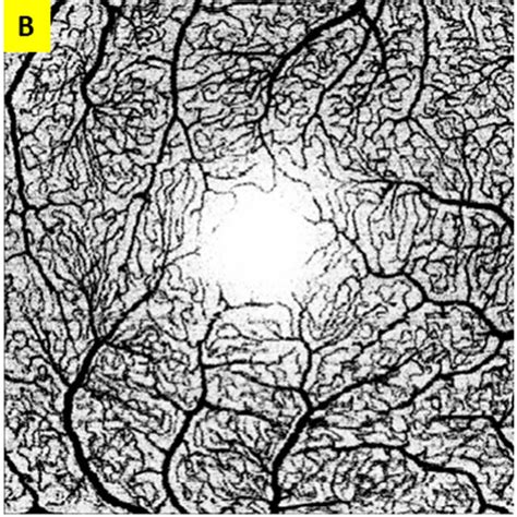 figure octa scan of the od svp a raw octa b inverted image of a