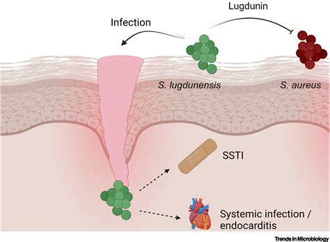 Staphylococcus Lugdunensis Trends In Microbiology