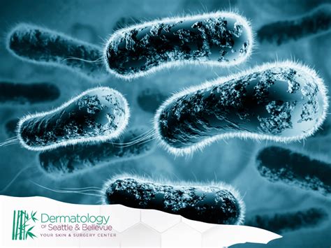 Bacterial Skin Infections Impetigo Cellulitis And Mrsa Explained