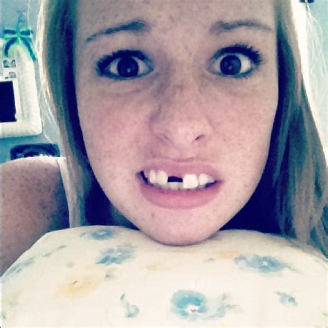 Toothless Girls Porn Pictures Xxx Photos Sex Images 2029462 Pictoa