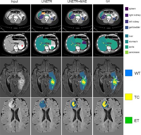 Figure From Self Pre Training With Masked Autoencoders For Medical Image Classification And