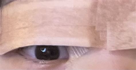 내돈내산 쌍꺼풀 수술 후기 매몰 쌍수 당일 주의사항 네이버 블로그