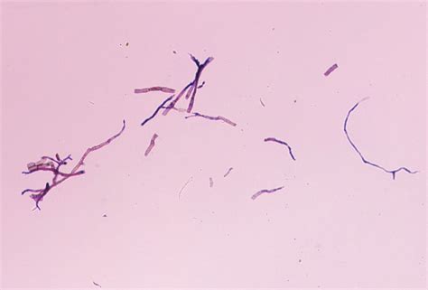 Mucoromycota Gmbank
