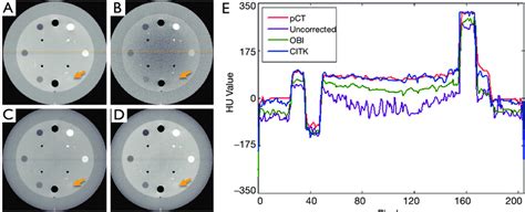 Schematic Diagram Of Image Processing Results A PCT Image B Download Scientific Diagram
