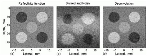Ultrasound Deconvolution Project