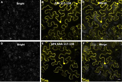 Subcellular Localization Patterns Of Δp4117138 Yfp And Download