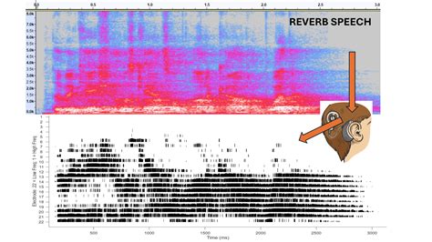 Why Do Cochlear Implant Users Struggle To Understand Speech In Echoey