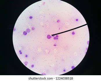 Polychromatophilic Erythroblast Blood Smear Stock Photo 1224038518 Shutterstock