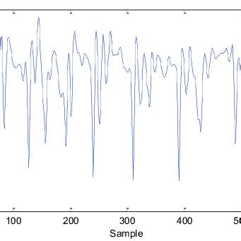 Example Of EEG Signal For An Epileptic Person Download Scientific Diagram