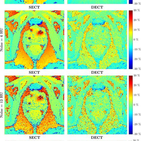 relative errors in on dose distributions calculated for sect and