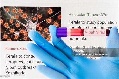 Blood Sample Tube For Nipah Virus Testblood Sample Tube For Nipah Virus