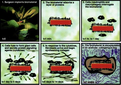 7 The Foreign Body Reaction Is The Normal Reaction Of A Higher Organism