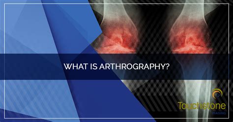 Arthrogram Joint X Ray Schedule Your Service Touchstone Imaging