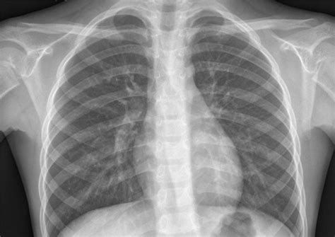 Datascience Python Neuralnetworks Tensorflow Ziv Ben Zvi