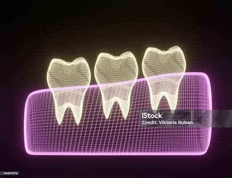치아 와이어 프레임 메쉬 네온 그리드 어금니 연결 구조입니다 치과 의학 건강 개념 3d 렌더 0명에 대한 스톡 사진 및 기타 이미지 Istock