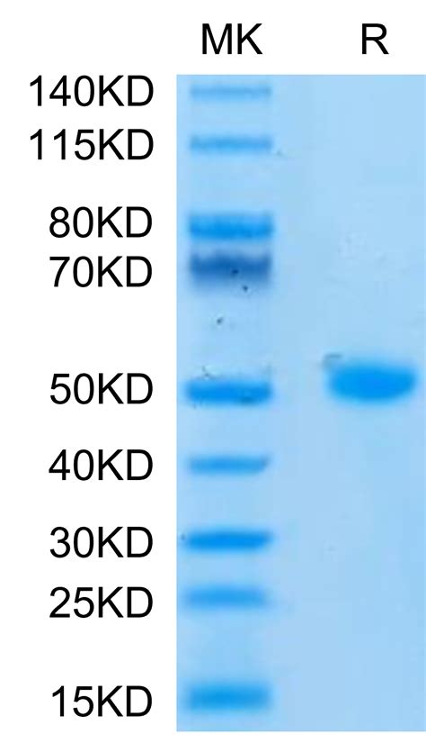 Human Cd137dc Sign Protein Recombinant Reprokine