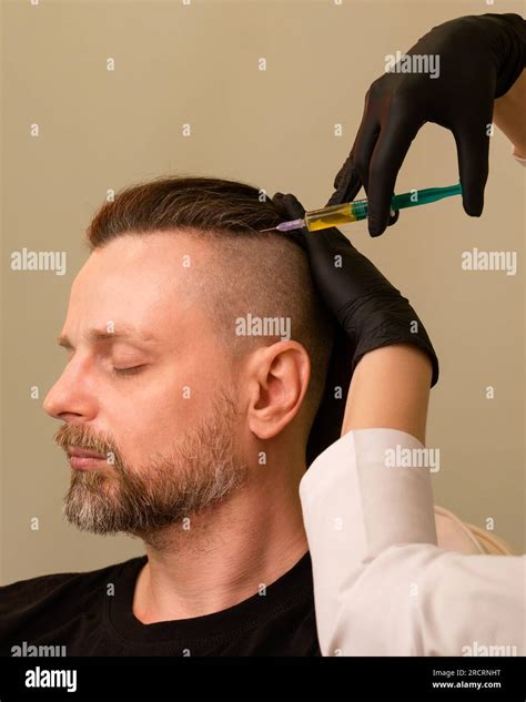 Esthetician Uses Thin Needle To Inject Platelet Rich Plasma In Scalp